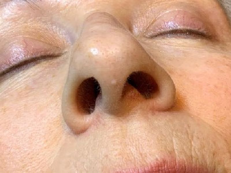 Case #2135 - Dr. Lee B. Daniel